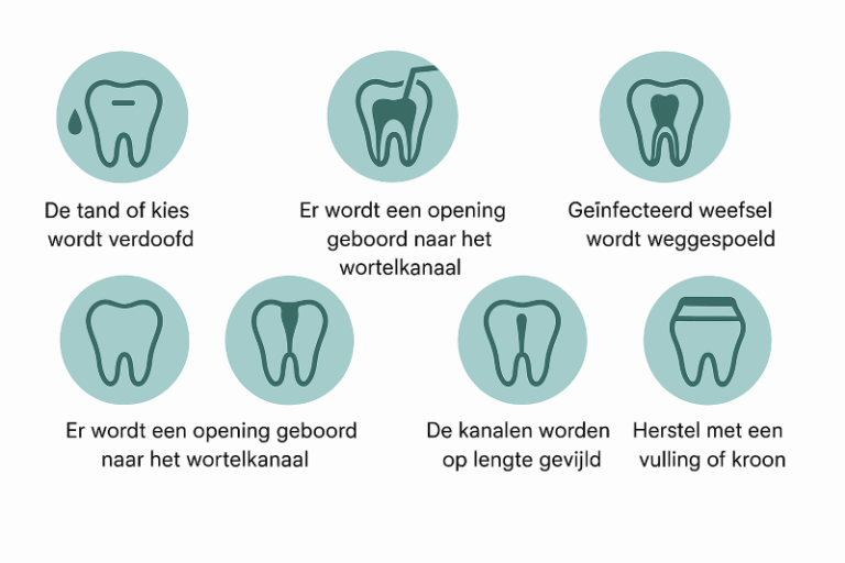 Kiespijn? Zo voorkom je erger – ook als je het druk hebt met je gezin ...